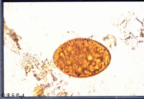 Diphyllobothrium latum 1.jpg