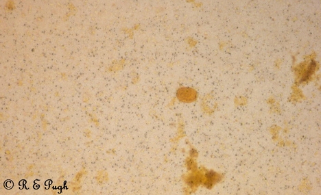 Heterophyid egg 03.jpg