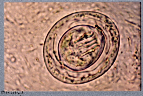 Hymenolepis nana 03.jpg