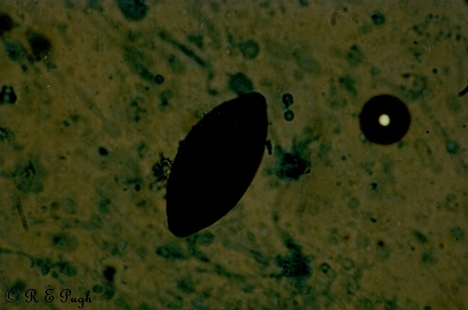 Trichuris vulpis 04.jpg